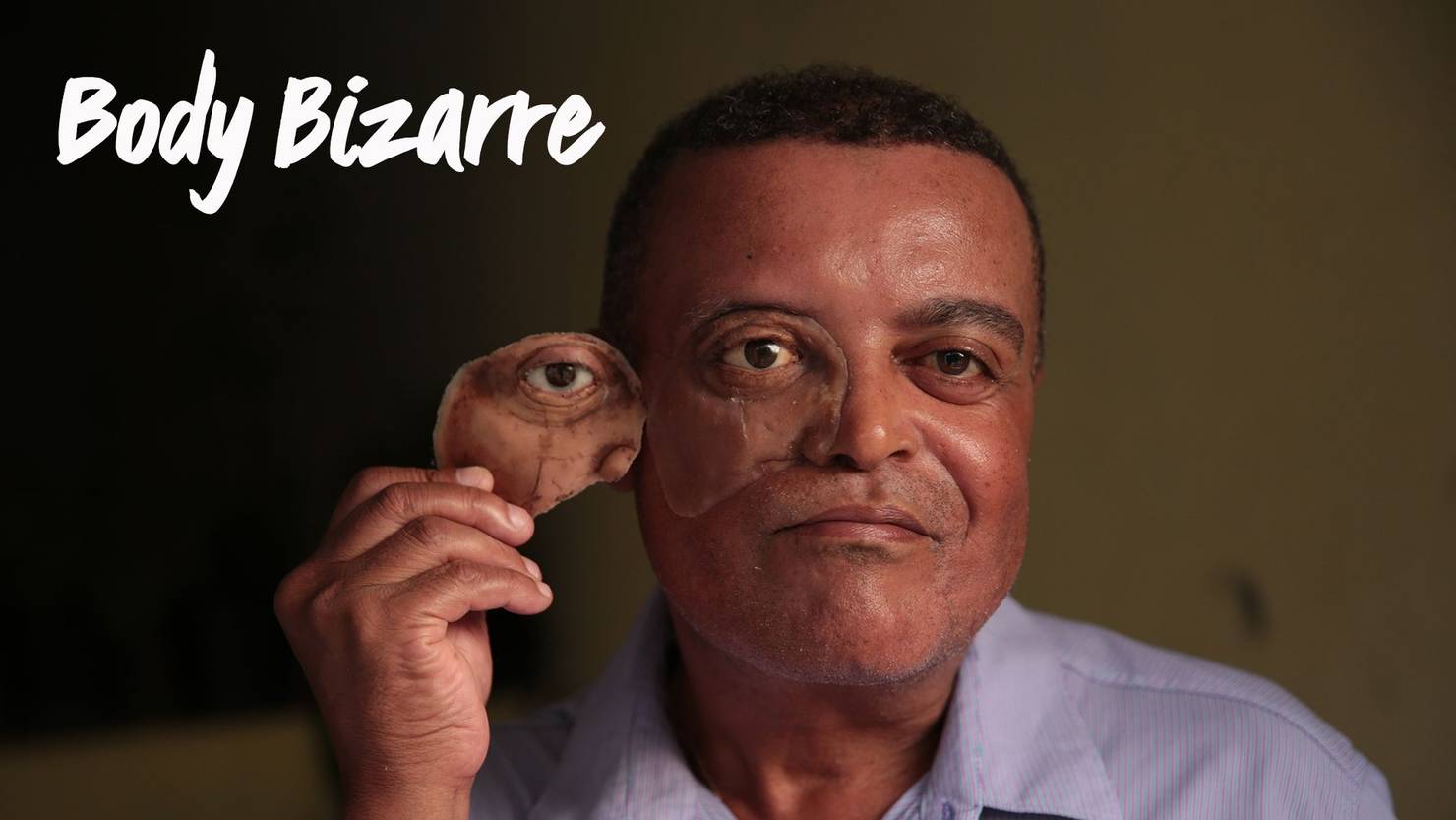 Body Bizarre - Unglaubliche Schicksale - 3+