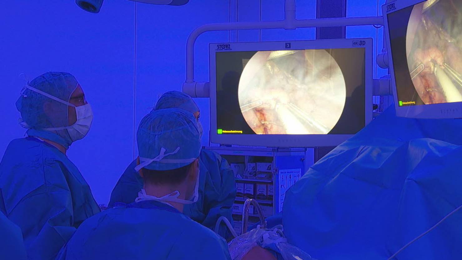 Adipositas-Serie «Der Magen wird so klein wie eine Kaffeetasse» – die ...